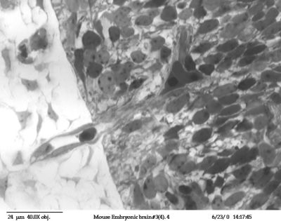 Mouse Embryo Brain - Mouse embryo brain #3(4)4