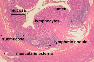 Vermiform Appendix Histology Vermiform Appendix An Overview