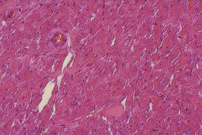 Human Heart Cells Under Microscope Micropedia Cardiac Muscle Tissue